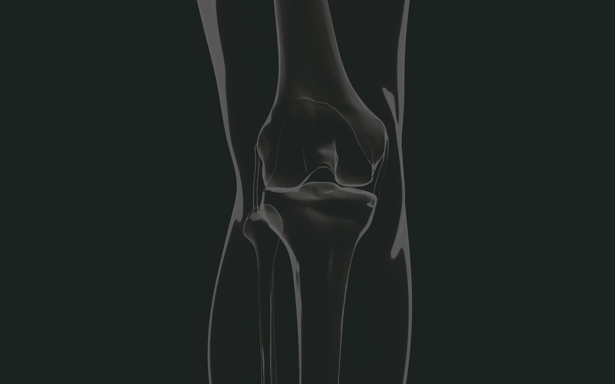 Pixee - A new vision for orthopedic surgery